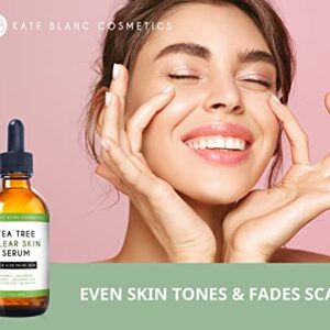 Tea Tree Serum for Face and Acne Prone Skin (1oz) by Kate Blanc Cosmetics. Tea Tree Oil Face Serum to Fight Acne Scars, Pimples, Dark Spots. Promotes Clear Skin for Teens