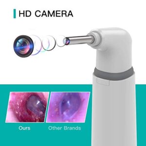 Wireless Otoscope Ear Camera with Dual View, 3.9mm 720PHD WiFi Ear Scope with 6 LED Lights for Kids and Adults, Compatible with Android and iPhone