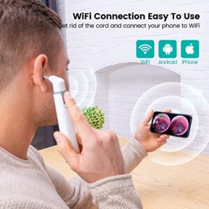 Wireless Otoscope Ear Camera with Dual View, 3.9mm 720PHD WiFi Ear Scope with 6 LED Lights for Kids and Adults, Compatible with Android and iPhone