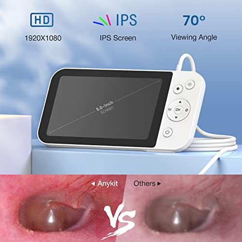 Ear Wax Removal Camera, Visual Ear Cleaner with 5" IPS Screen, Digital Otoscope with Ear Cleaning Tool, 32G Card, HD Video Ear Scope Supports Photo Snap and Video Recording.