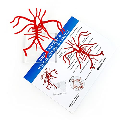 Evotech Brain Artery Model, Life Size Intracranial Artery Model, Shows Internal Carotid Artery, Willis Circle and Basillary Artery & Their Branches. On a Plexiglass Base