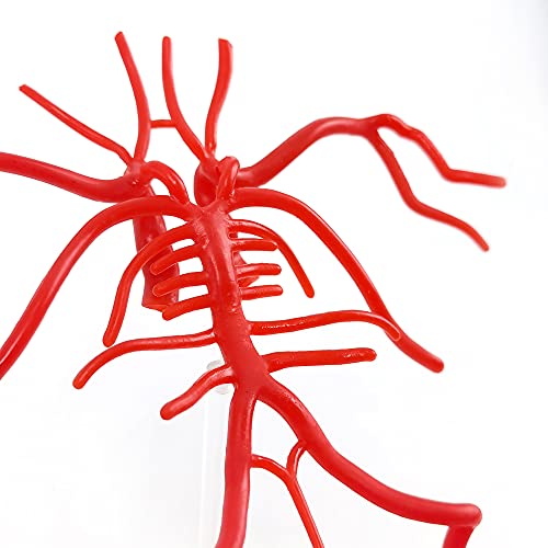 Evotech Brain Artery Model, Life Size Intracranial Artery Model, Shows Internal Carotid Artery, Willis Circle and Basillary Artery & Their Branches. On a Plexiglass Base