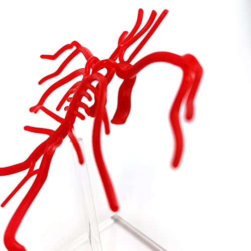 Evotech Brain Artery Model, Life Size Intracranial Artery Model, Shows Internal Carotid Artery, Willis Circle and Basillary Artery & Their Branches. On a Plexiglass Base