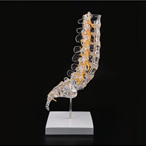 Ultrassist Human Lumbar Spine Model with Sacrum, Spinal Nerves and Herniation Disc, Includes Base for Display, Life Size Spine Model for Medical Education