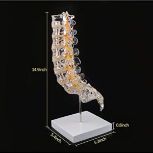 Ultrassist Human Lumbar Spine Model with Sacrum, Spinal Nerves and Herniation Disc, Includes Base for Display, Life Size Spine Model for Medical Education