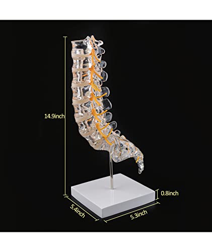 Ultrassist Human Lumbar Spine Model with Sacrum, Spinal Nerves and Herniation Disc, Includes Base for Display, Life Size Spine Model for Medical Education