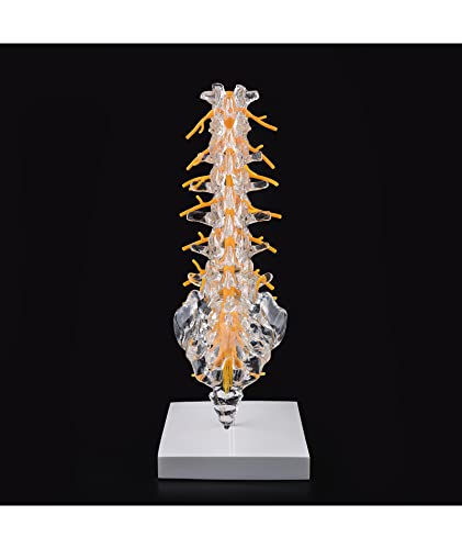 Ultrassist Human Lumbar Spine Model with Sacrum, Spinal Nerves and Herniation Disc, Includes Base for Display, Life Size Spine Model for Medical Education