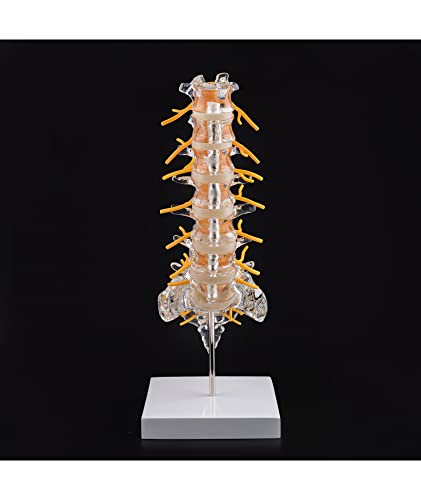 Ultrassist Human Lumbar Spine Model with Sacrum, Spinal Nerves and Herniation Disc, Includes Base for Display, Life Size Spine Model for Medical Education