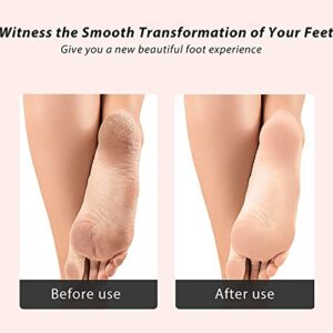 ICANdOIT-4 in 1 Foot File Callus Remover with Long Handle Classic Dry Brushing Body Brush Back Scrubber,Shower Brush for exfoliator Skin and Remove Dead Skin Cells