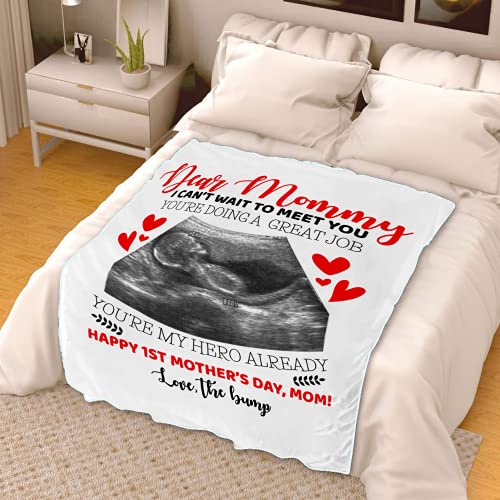 Personalized Sonogram Photo Blanket for Parents to Be Customized Ultrasound Picture Blanket for First Time Mom Dad Unique Custom Sonogram Picture Pregnancy Announcement Fleece Throw (50x60)