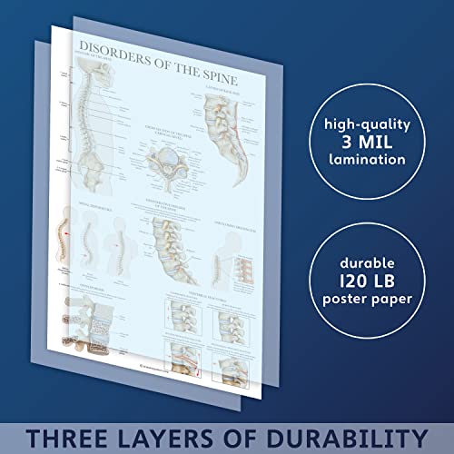 2 Pack: Spinal and Cranial Nerves + Disorders of the Spine Poster Set - Set of 2 Anatomical Charts - Laminated - 18" x 24"