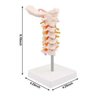 Ultrassist Cervical Spine Model with Cervical Vertebrae, Cervical Nerves, Vertebral Arteries & Occipital Plate for Medical Education