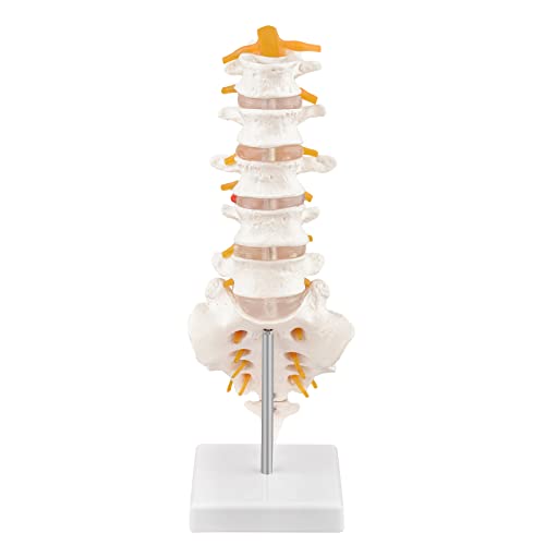 Ultrassist Human Spine Model with 5 Lumbar Vertebrae, Herniation Discs, Lumbar Nerves and Spinal Cord for Medical Teaching