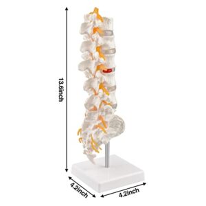 Ultrassist Human Spine Model with 5 Lumbar Vertebrae, Herniation Discs, Lumbar Nerves and Spinal Cord for Medical Teaching