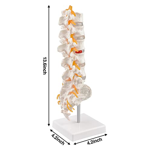 Ultrassist Human Spine Model with 5 Lumbar Vertebrae, Herniation Discs, Lumbar Nerves and Spinal Cord for Medical Teaching