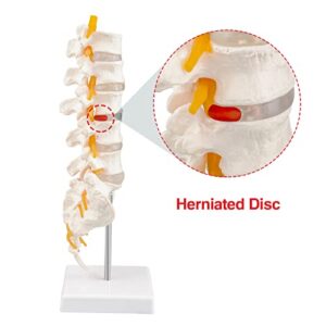 Ultrassist Human Spine Model with 5 Lumbar Vertebrae, Herniation Discs, Lumbar Nerves and Spinal Cord for Medical Teaching