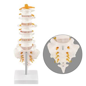 Ultrassist Human Spine Model with 5 Lumbar Vertebrae, Herniation Discs, Lumbar Nerves and Spinal Cord for Medical Teaching