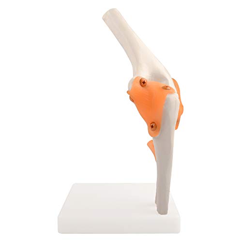 Ultrassist Human Elbow Model with Ligaments, Life Size Elbow Anatomy Model with Study Card, Best Teaching Tool for Patient Education & Anatomy Study