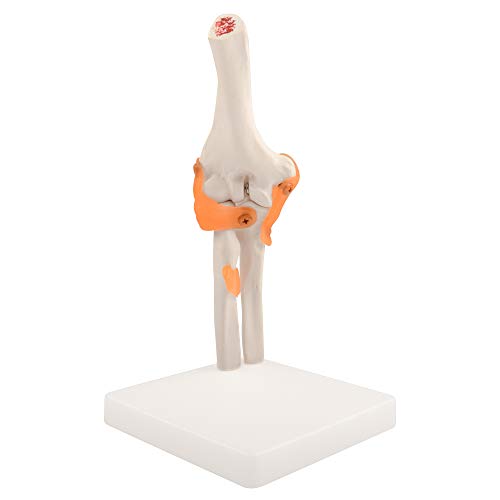 Ultrassist Human Elbow Model with Ligaments, Life Size Elbow Anatomy Model with Study Card, Best Teaching Tool for Patient Education & Anatomy Study