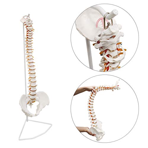 Ultrassist Life Size Human Spine Model, 34" Flexible Spinal Cord with Hyoid Bone, Herniated Disk, Nerves, Arteries and Pelvis, Teaching Tool for Medical Students and Chiropractors, Includes Stand