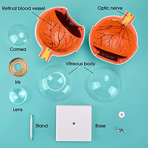 Ultrassist Human Eye Model 6X Enlarged with Removable Stand, Anatomical Eyeball Model for Science Classroom Study Display Medical Education