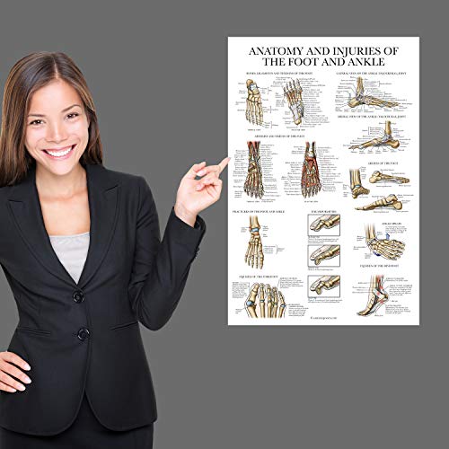 Palace Learning Laminated Anatomy and Injuries of the Foot and Ankle Poster - Anatomical Chart of Foot and Ankle Joint - 18" x 24"