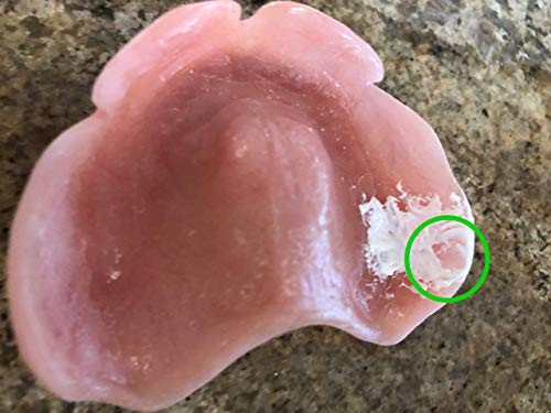 Denture Sore Spot Find And Remove Kit