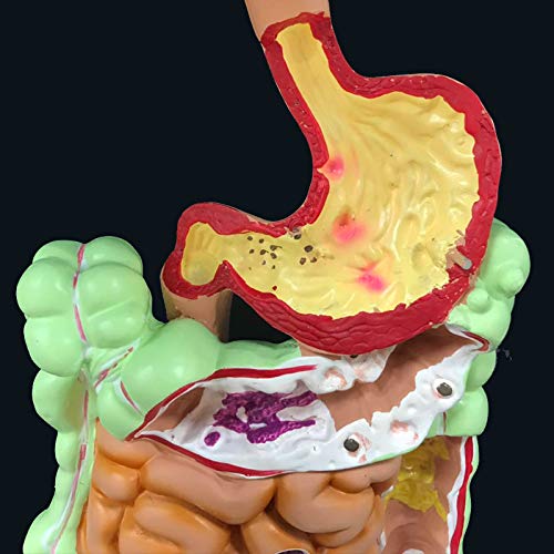 Human Digestive System Stomach Anatomy Model The Large Intestine Cecum Rectum Duodenum Anatomy Model Medical Teaching Supplies