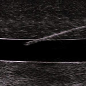 Ultrasound Central Line Training Model - CVL Phantom for Practice