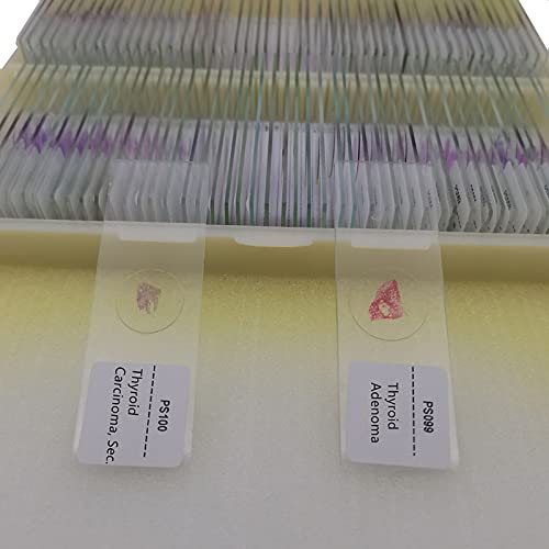 Human Pathological Section Prepared Tissue Specimen Slides 100pcs/box