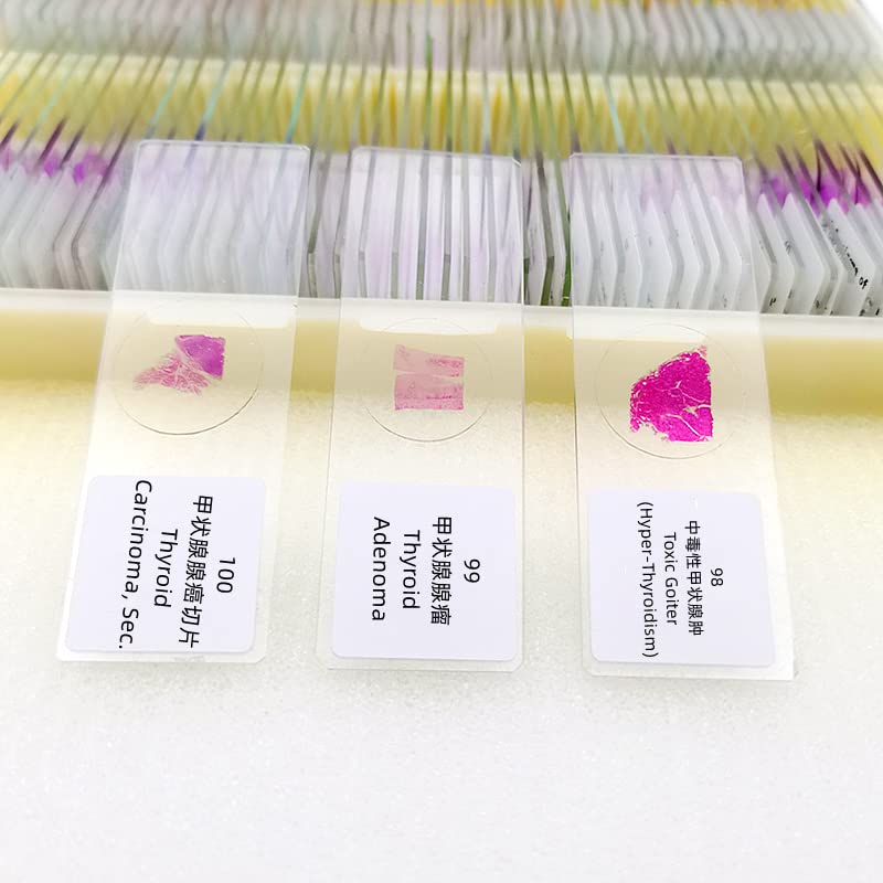 Human Pathological Section Prepared Tissue Specimen Slides 100pcs/box