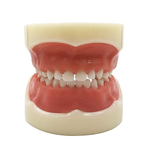 Typodont Child Teeth Model, with 24pcs Removable Teeth, Compatible with Kilgore Nissin for Teaching, Study