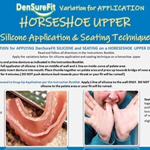 DenSureFit Upper Denture Reline Kit