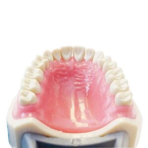 Typodont Teeth Model, with Removable Teeth, Compatible with Kilgore Nissin for Teaching, Study