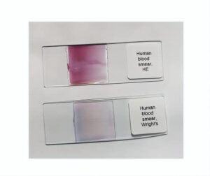 2pcs human blood smear, he stain & wright's stain, for observation of red and white blood cells