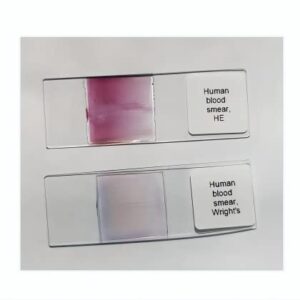 2pcs Human Blood Smear, HE Stain & Wright's Stain, for Observation of Red and White Blood Cells