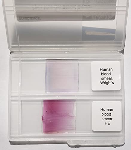 2pcs Human Blood Smear, HE Stain & Wright's Stain, for Observation of Red and White Blood Cells