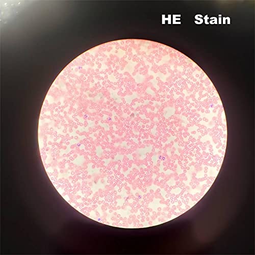 2pcs Human Blood Smear, HE Stain & Wright's Stain, for Observation of Red and White Blood Cells