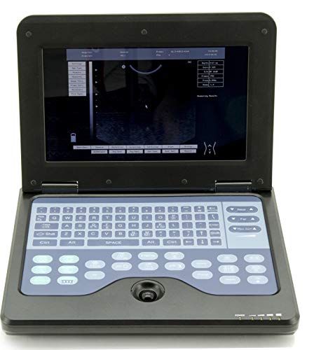 CONTEC Vet/Veterinary/Animal Portable B-Ultrasound Scanner with Tow Probes Convex and Rectal Probe for Cattle,Horse,Camel,Equine,Goat,Cow,Sheep and Pig