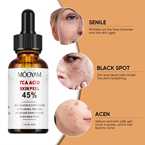 Facial Peeling Serum with 45% Citric Acid Facial Deep Exfoliating Face Chemical Peel for Acne Dark Spots Wrinkles and Fine Lines-Skin Brightening Tightening Moisturizing Serum 30 ml/1 Fl oz