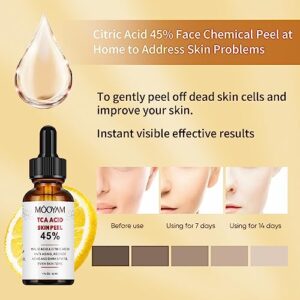 Facial Peeling Serum with 45% Citric Acid Facial Deep Exfoliating Face Chemical Peel for Acne Dark Spots Wrinkles and Fine Lines-Skin Brightening Tightening Moisturizing Serum 30 ml/1 Fl oz