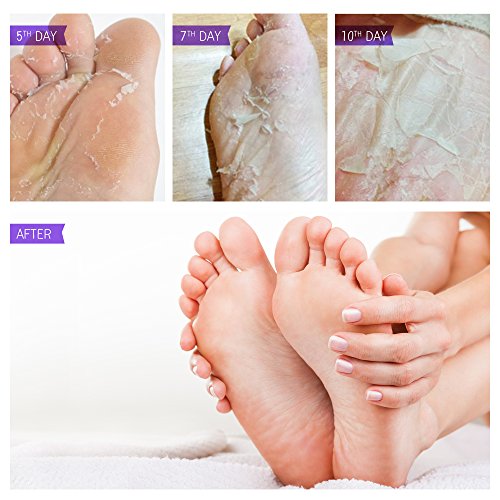 Foot Peel Mask - Exfoliator Peel Off Calluses Dead Skin, Foot Spa and Callus Remover - Baby Soft Smooth Touch Feet with Lavender and Aloe Vera for Men and Women (2 Pairs)