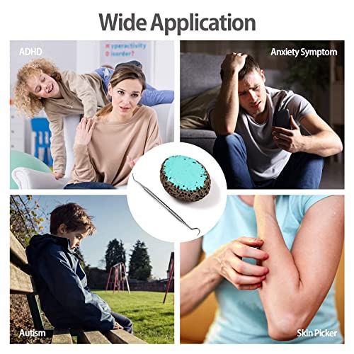 Xipeel Pick Peel Stone Kit - Fidget Toy Anxiety Relief Mental Relaxation for Children and Adults with ADHD OCD Excoriation