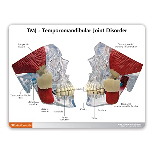 GPI Anatomicals - Temporomandibular Joint (TMJ) Model, Replica with Pathologies for Human Anatomy and Physiology Education, Anatomy Model for Doctor's Offices and Classrooms, Medical Study Supplies