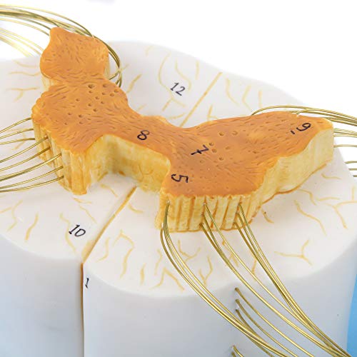 Axis Scientific Enlarged Spinal Cord Model, 8X Life Size Nerves Plus Anterior and Posterior Nerve Roots and Spinal Ganglion - Includes Product Manual, and Base for Display