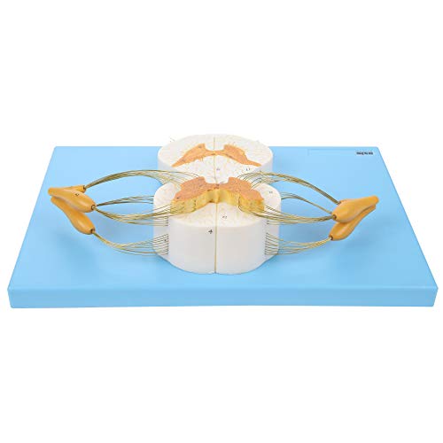 Axis Scientific Enlarged Spinal Cord Model, 8X Life Size Nerves Plus Anterior and Posterior Nerve Roots and Spinal Ganglion - Includes Product Manual, and Base for Display