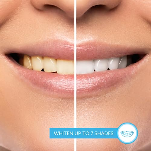 GO SMILE Professional Teeth Whitening Gel (3.4 oz) & Luxury Whitening Vitamin Enhanced Toothpaste (3.4 oz) - Travel Size Tooth Enamel Whitener & Stain Remover, No Added Sensitivity - Refreshing Mint