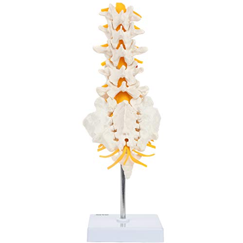 Axis Scientific Lumbar Spine Anatomy Model with Sacrum and Spinal Nerves, Lumbar Vertebrae, Vertebral Model, Spinal Model Didactic Replica of Lumbrosacral Section with Nerves, Herniated Disc at L4, Includes Base for Display