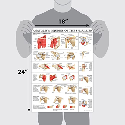 Palace Learning LAMINATED Anatomy and Injuries of the Shoulder Poster - Shoulder Joint Anatomical Chart