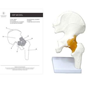 Hip Joint Anatomical Cast Scientific Model by Trademark Scientific